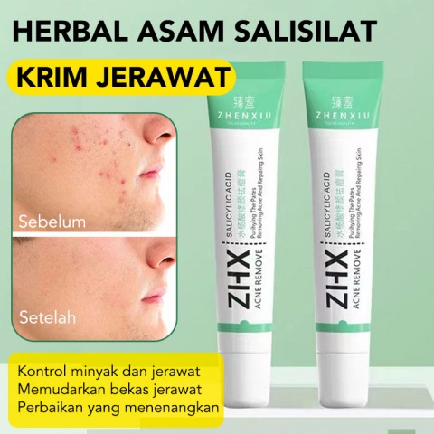Krim jerawat kontrol minyak herbal asam salisilat